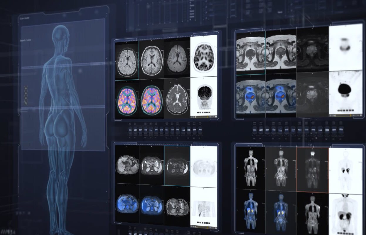 Molecular Imaging - Med I (Thailand) Co. Ltd